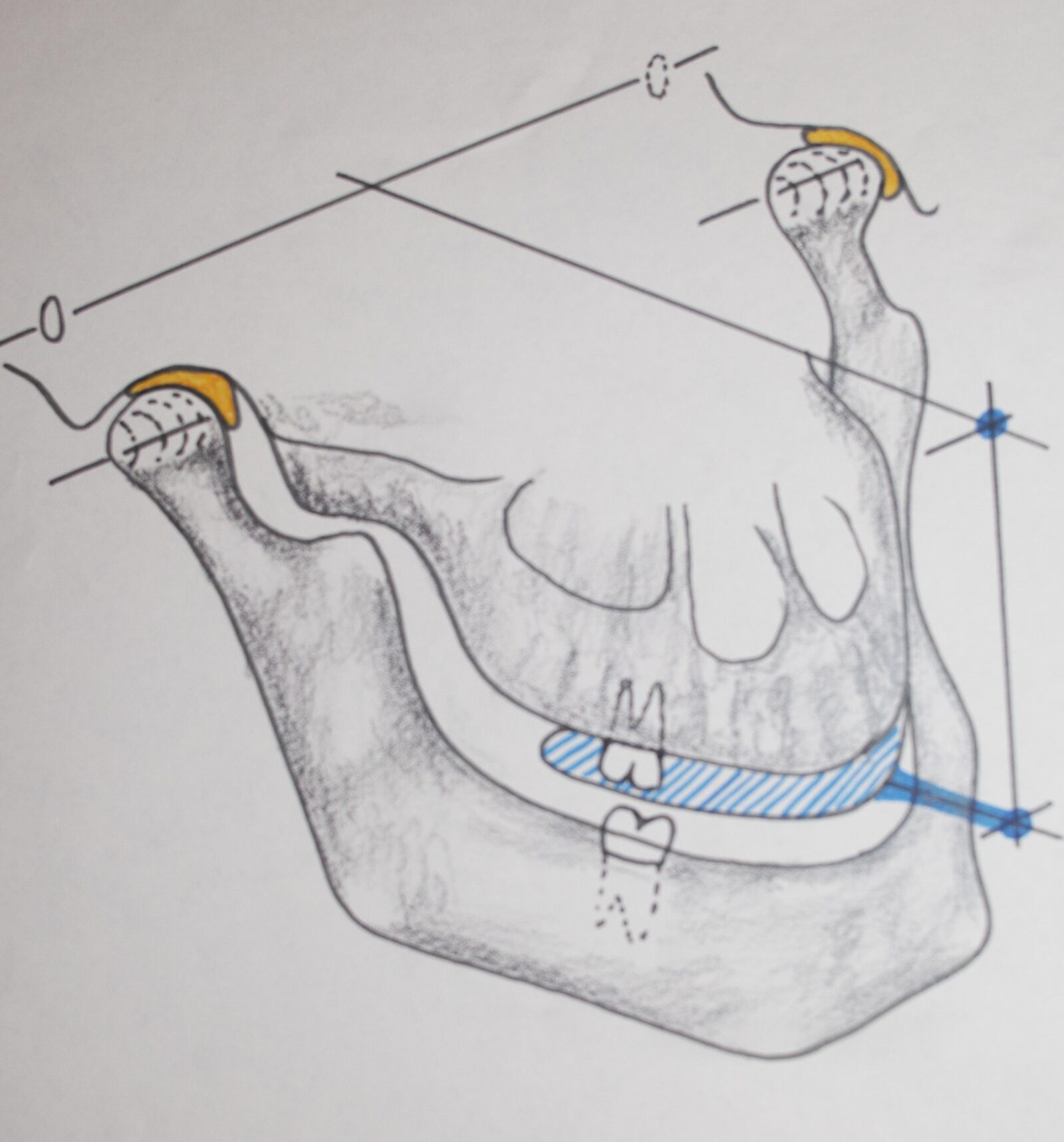 The TMJ (Temporomandibular Joint) - II.4 – The Center for Dental Education